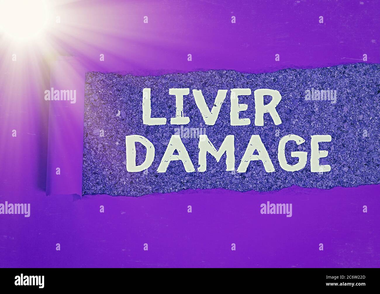 Word writing text Liver Damage. Business photo showcasing any disorder ...