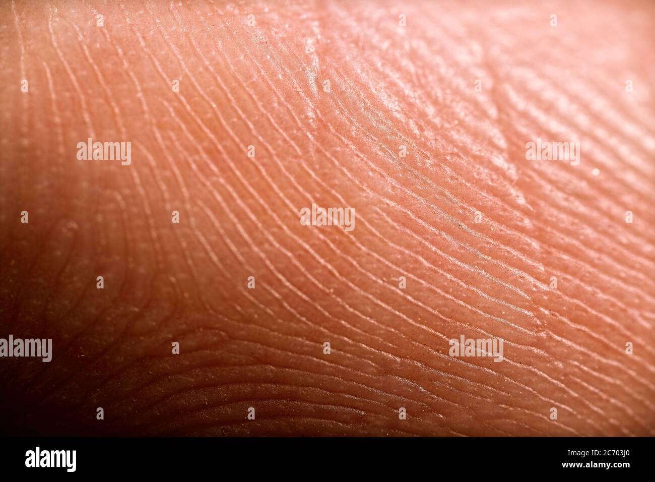 Detailed macro photo of human skin. Detailed texture. Closeup ...