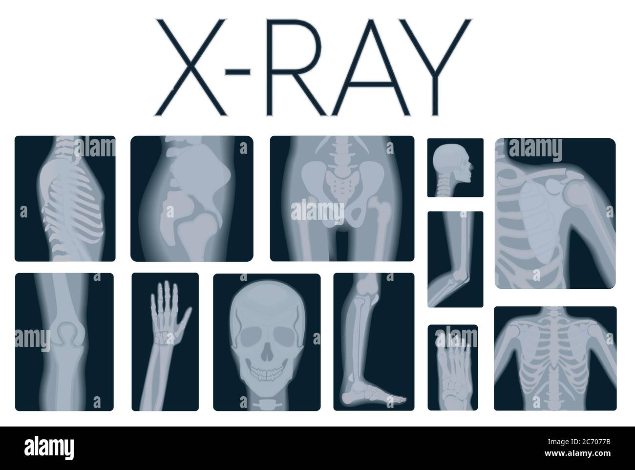 Foot diagnosis Cut Out Stock Images & Pictures - Alamy