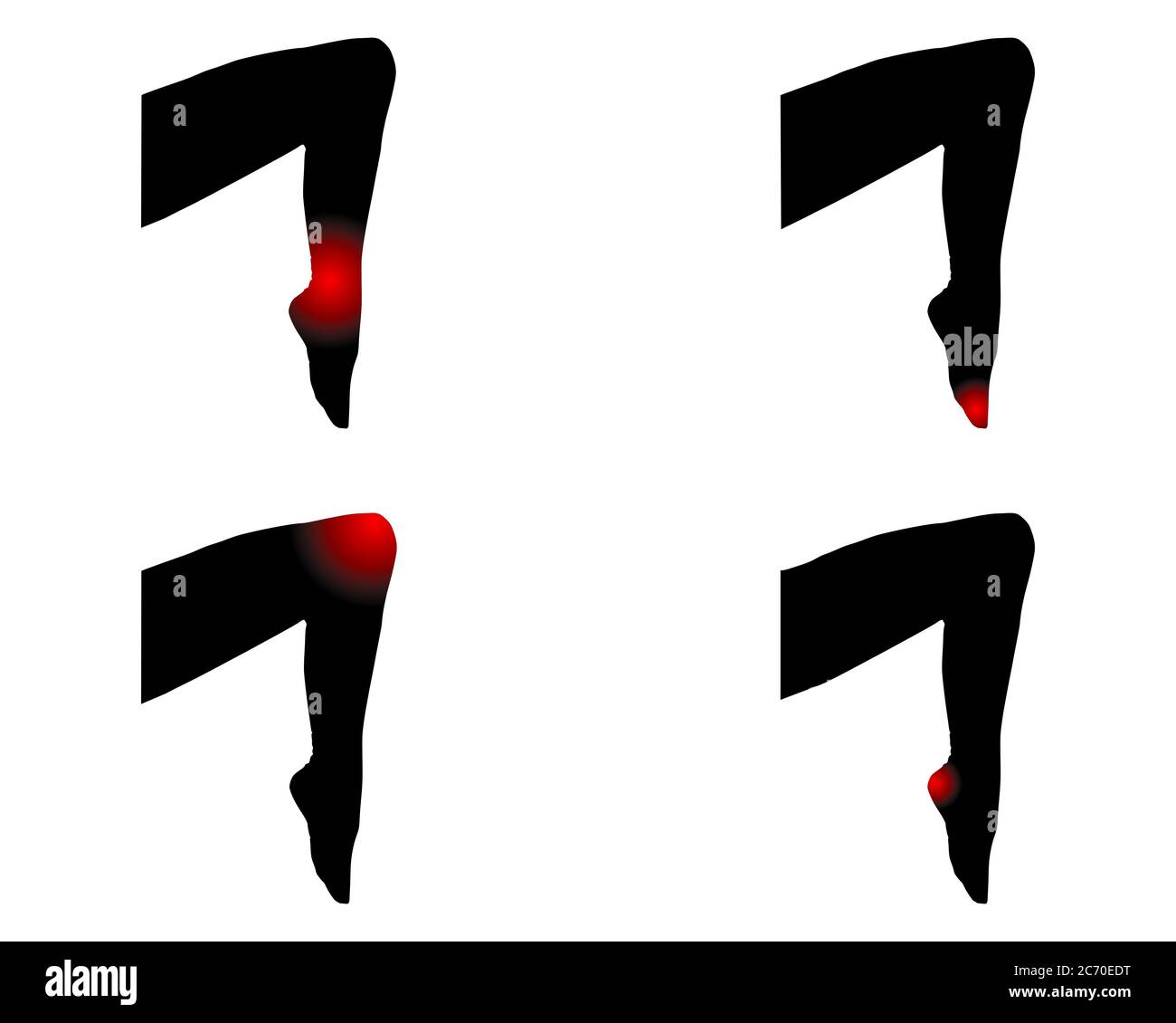 Human legs with pain points Stock Photo - Alamy