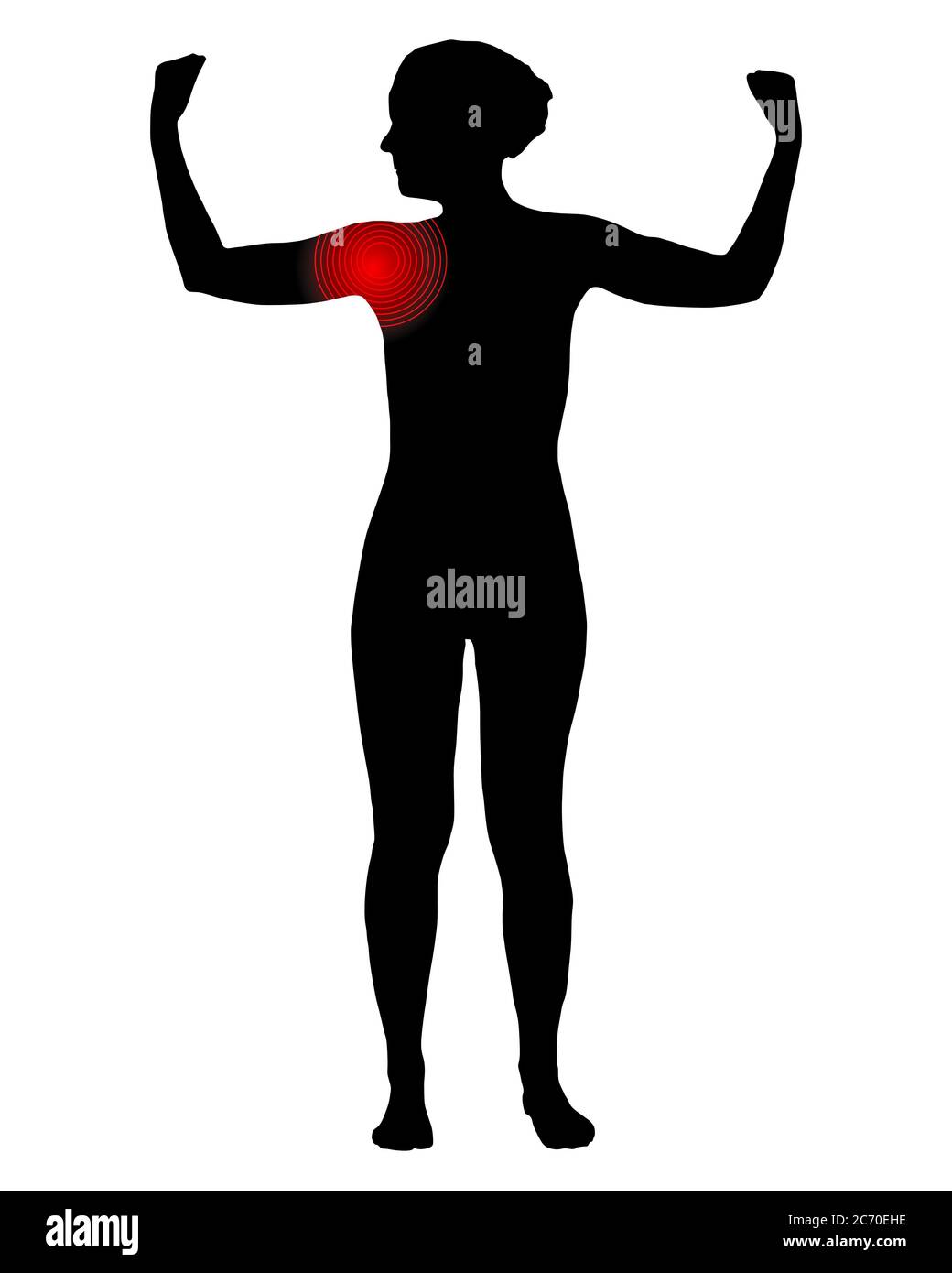 Front view of woman with pain in upper arm Stock Photo - Alamy