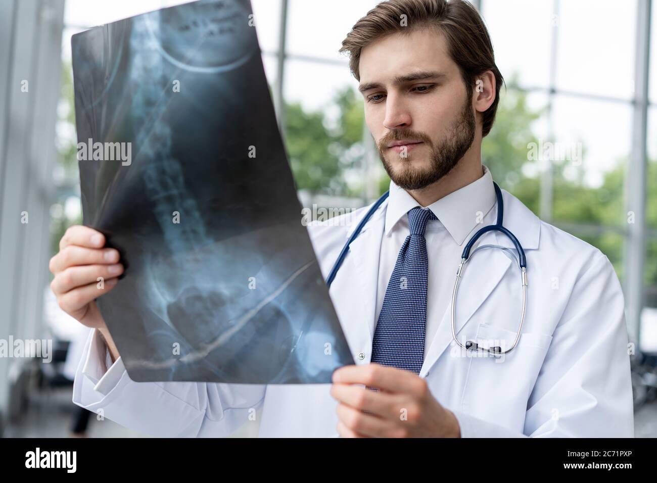 hospital doctor holding patient's x-ray film, radiologist studying x ...