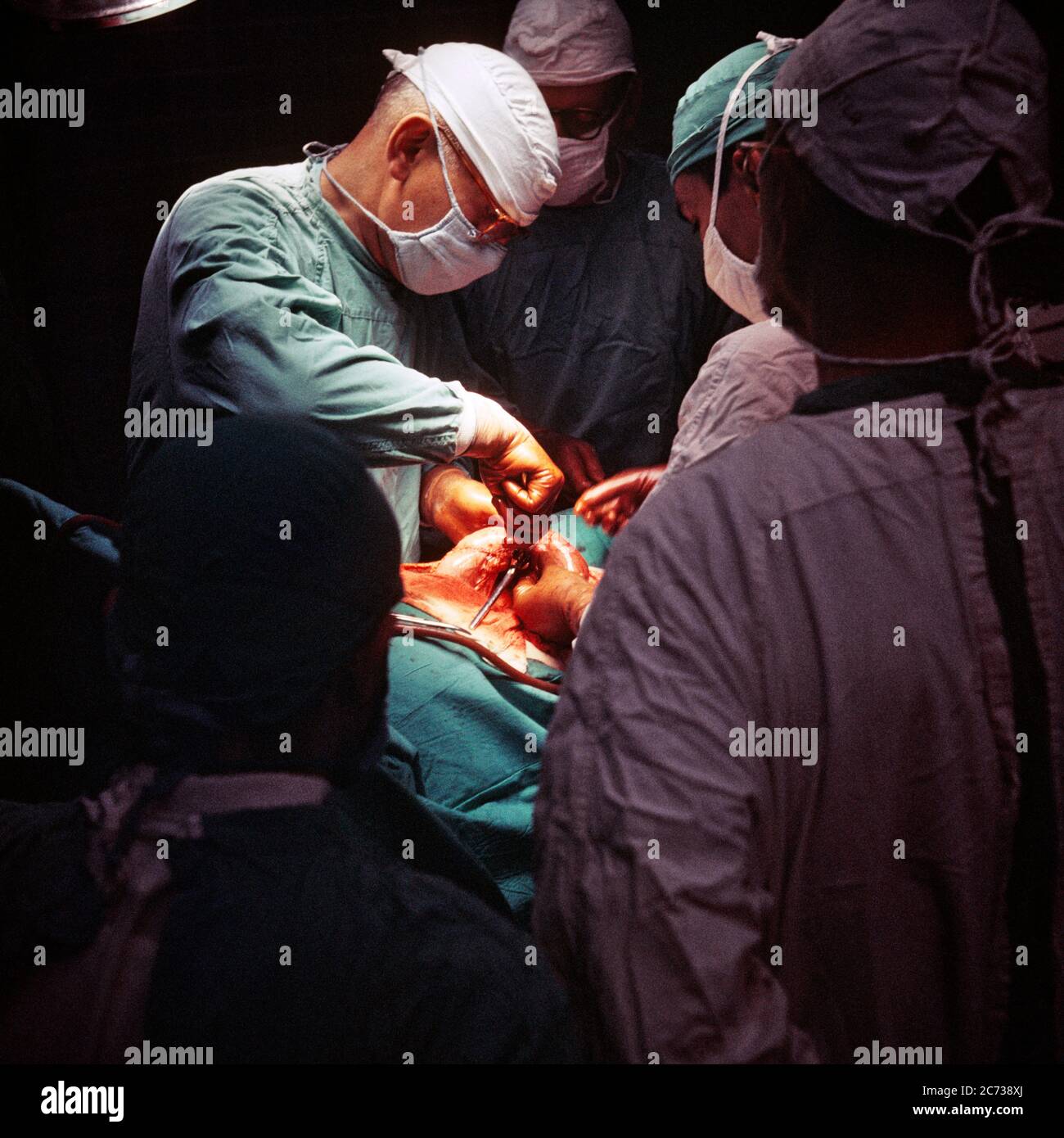 1960s 1970s ANONYMOUS TEAM OF LEAD SURGEON ASSISTANT SURGEONS AND ...