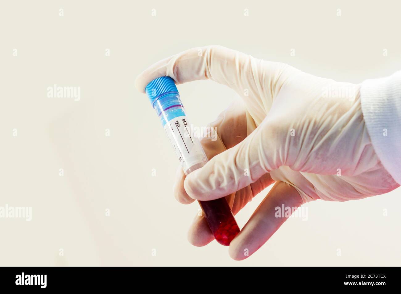 Test tubes full blood hi-res stock photography and images - Alamy