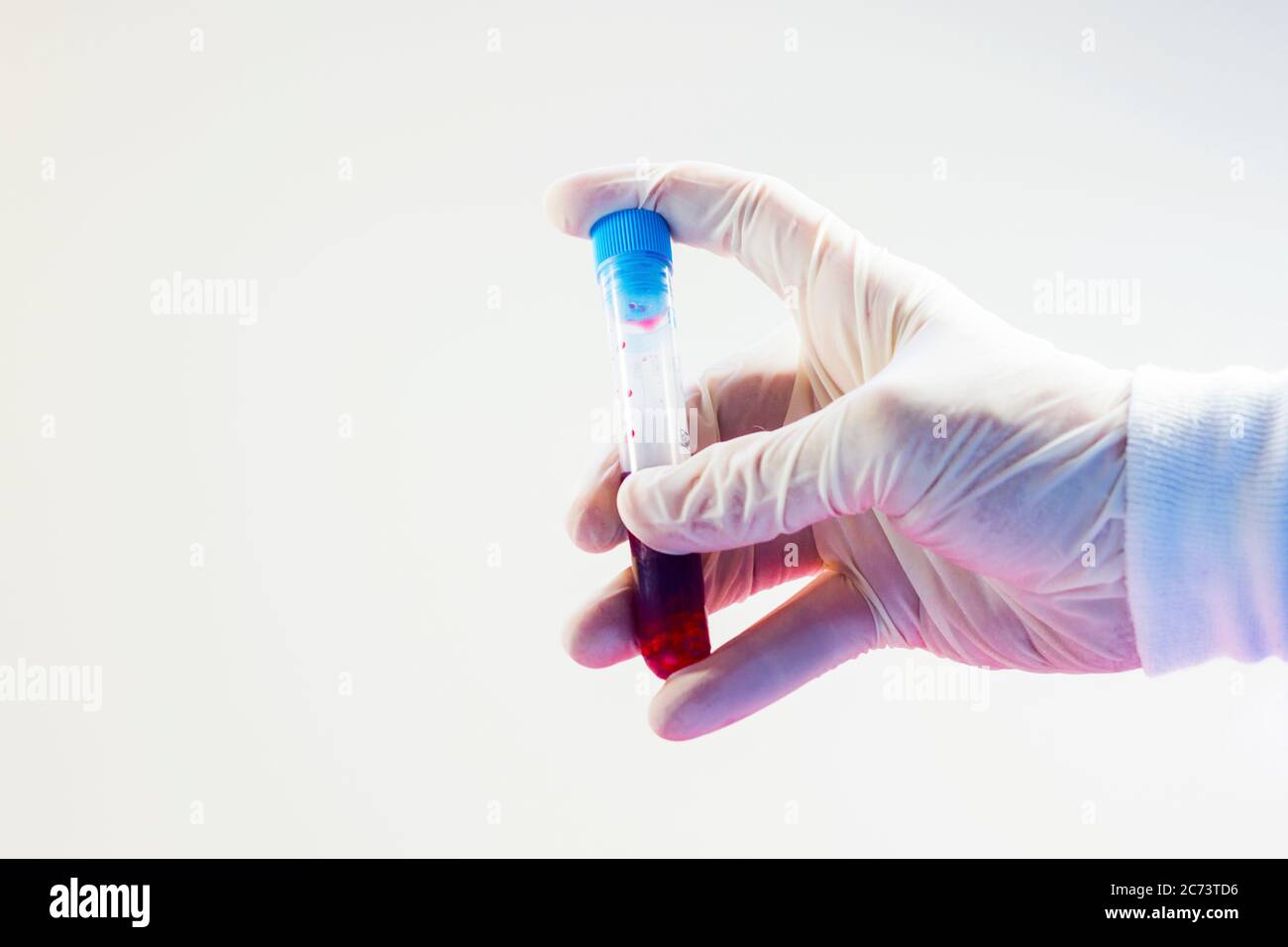 Blood test full tubes in doctor's hand, on the white background, studio ...