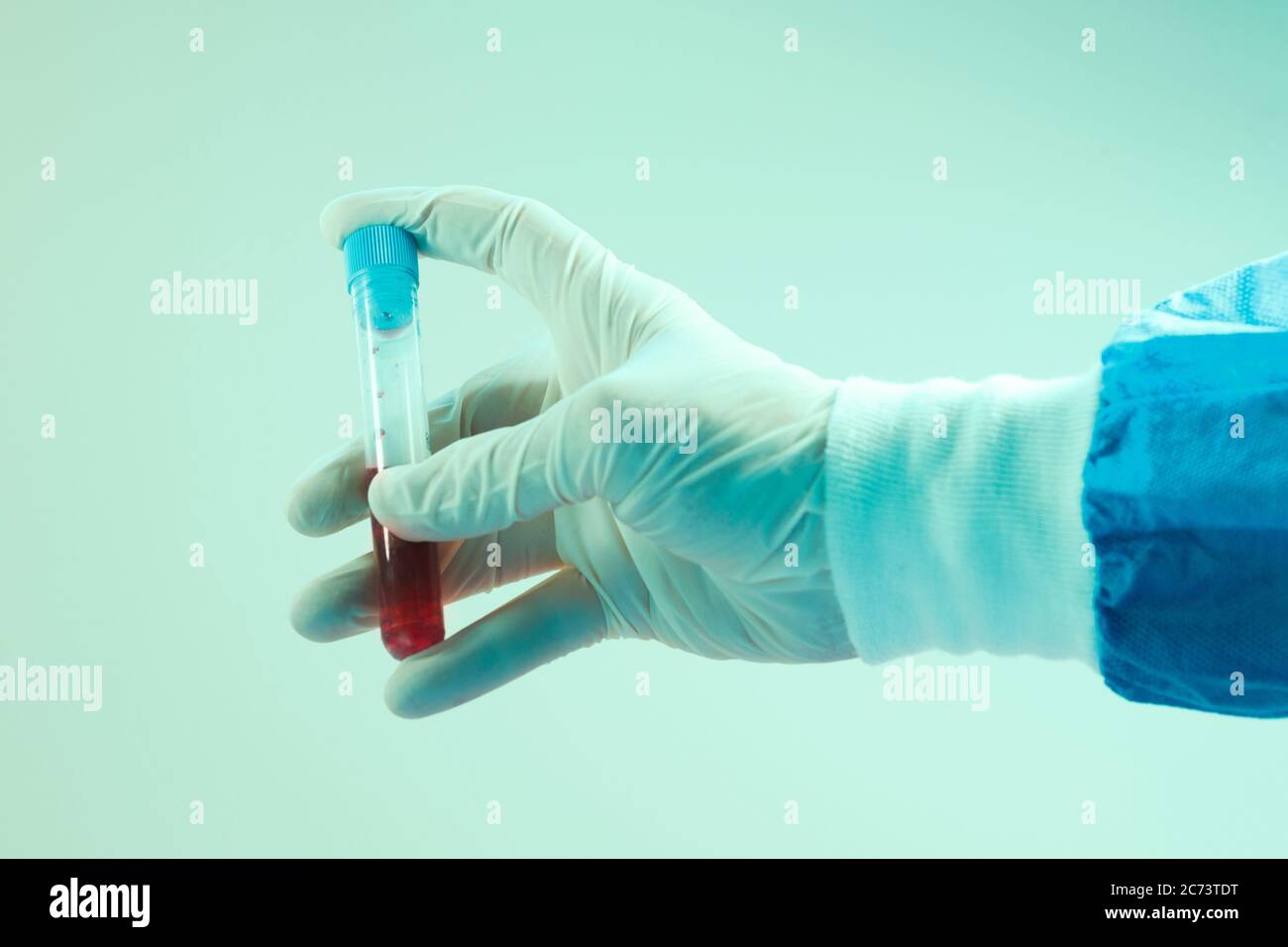 Blood test full tubes in doctor's hand, on the white background, studio ...