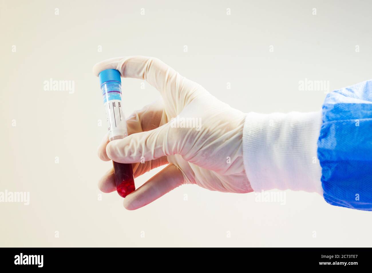 Blood test full tubes in doctor's hand, on the white background, studio ...