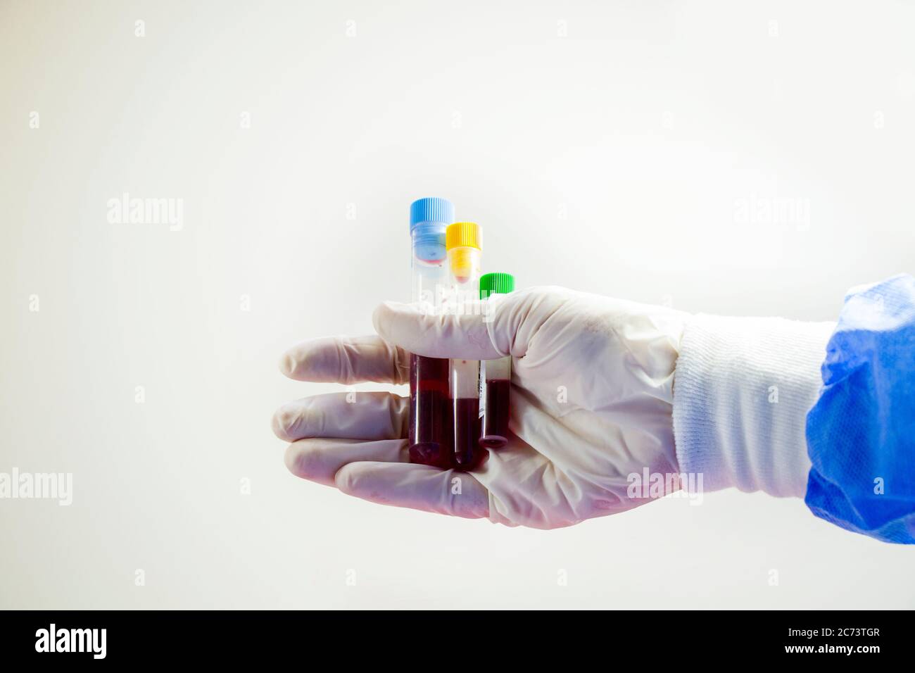 Blood test full tubes in hand, holding tubes,on the white background ...