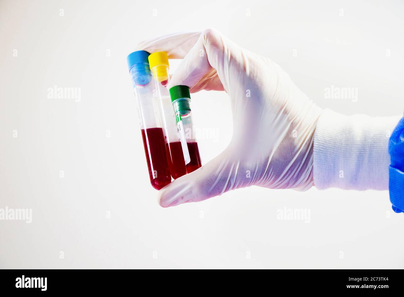 Blood test full tubes in hand, holding tubes,on the white background ...