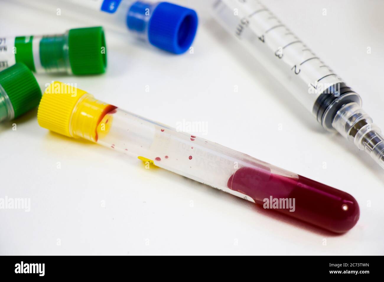 Blood test full tubes samples on the white background, studio shoot ...