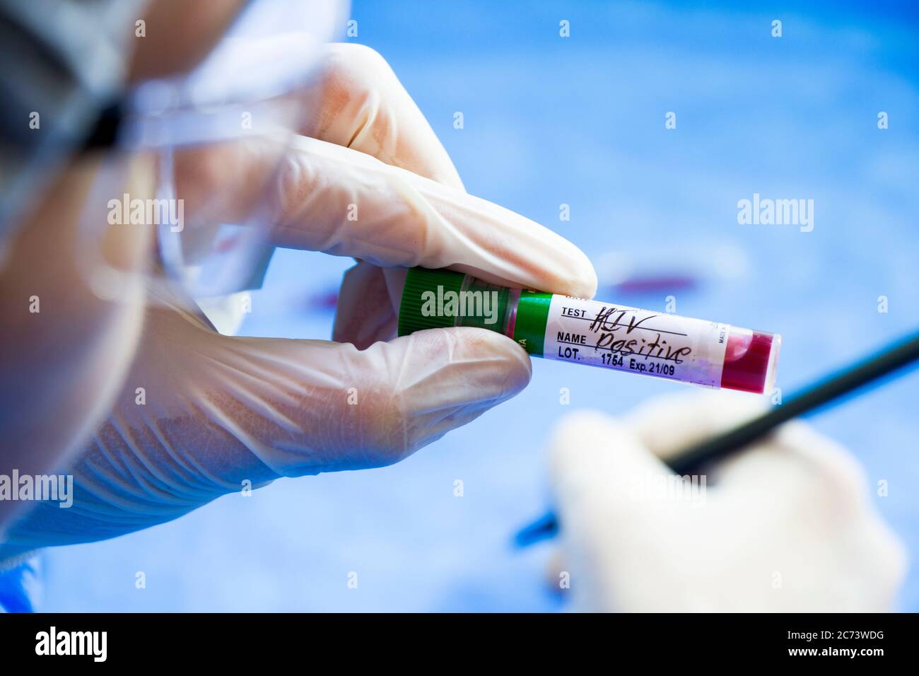Hiv and aids infection test, doctors face and hand holding tube with ...
