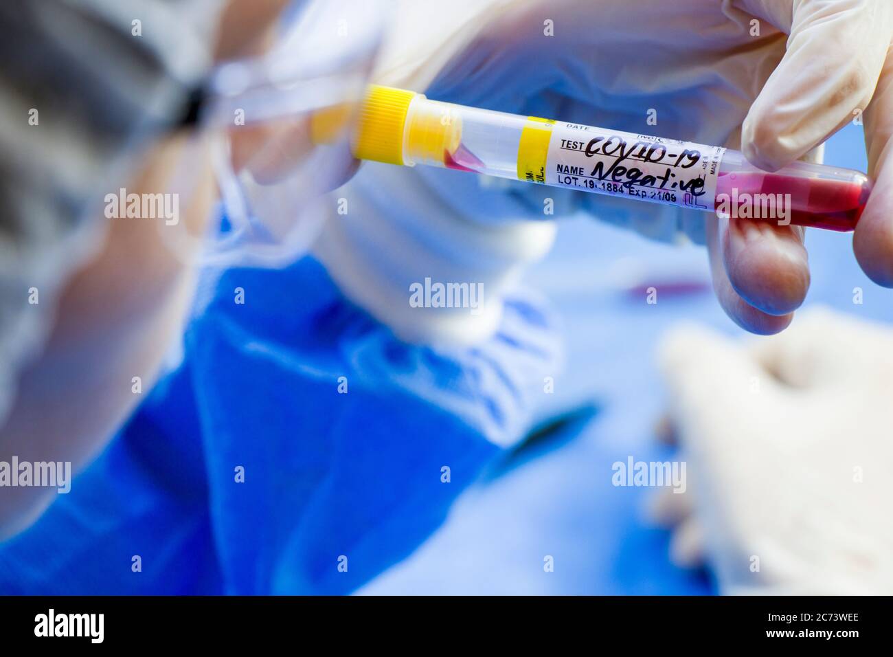 Corona virus negative blood test tubes on the white background, studio ...