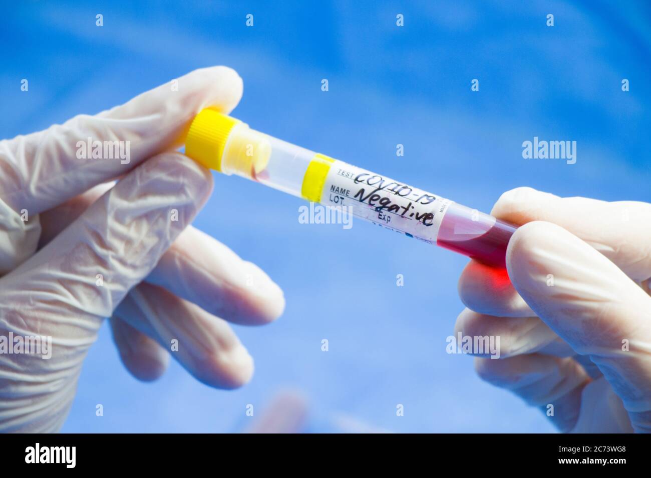 Corona virus negative blood test tubes on the white background, studio ...