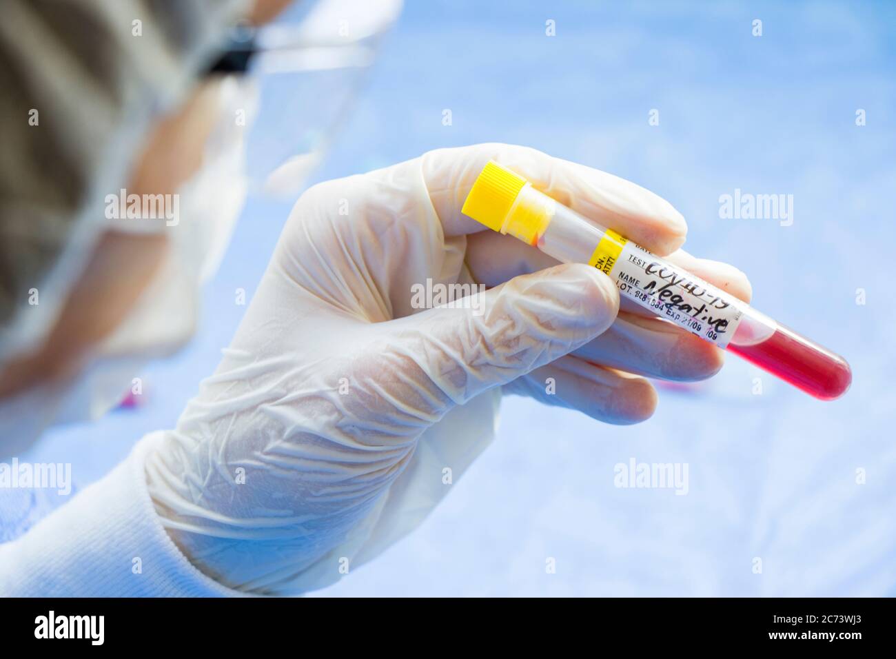Corona virus negative blood test tubes on the white background, studio ...