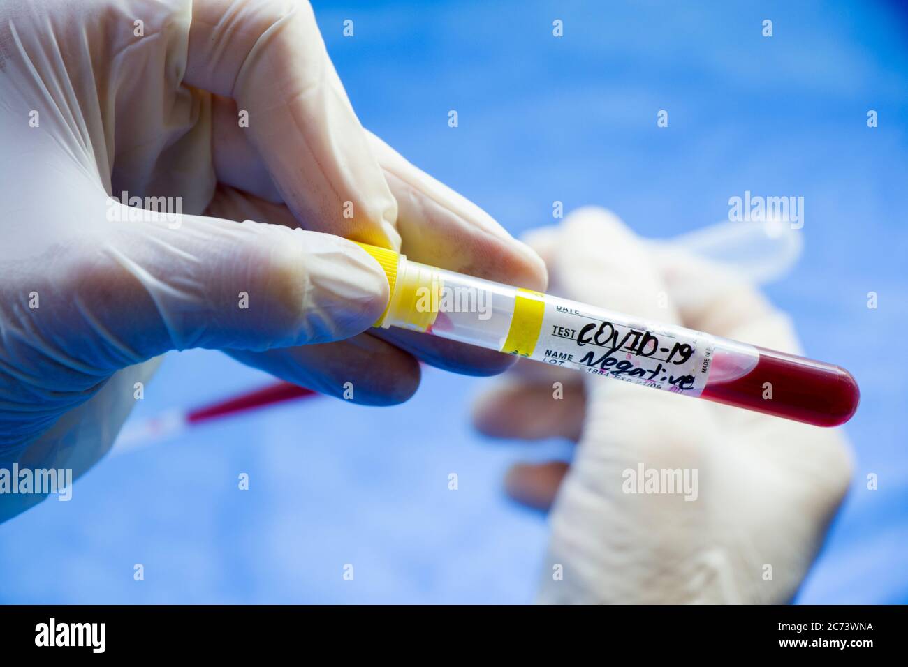 Corona virus negative blood test tubes on the white background, studio ...