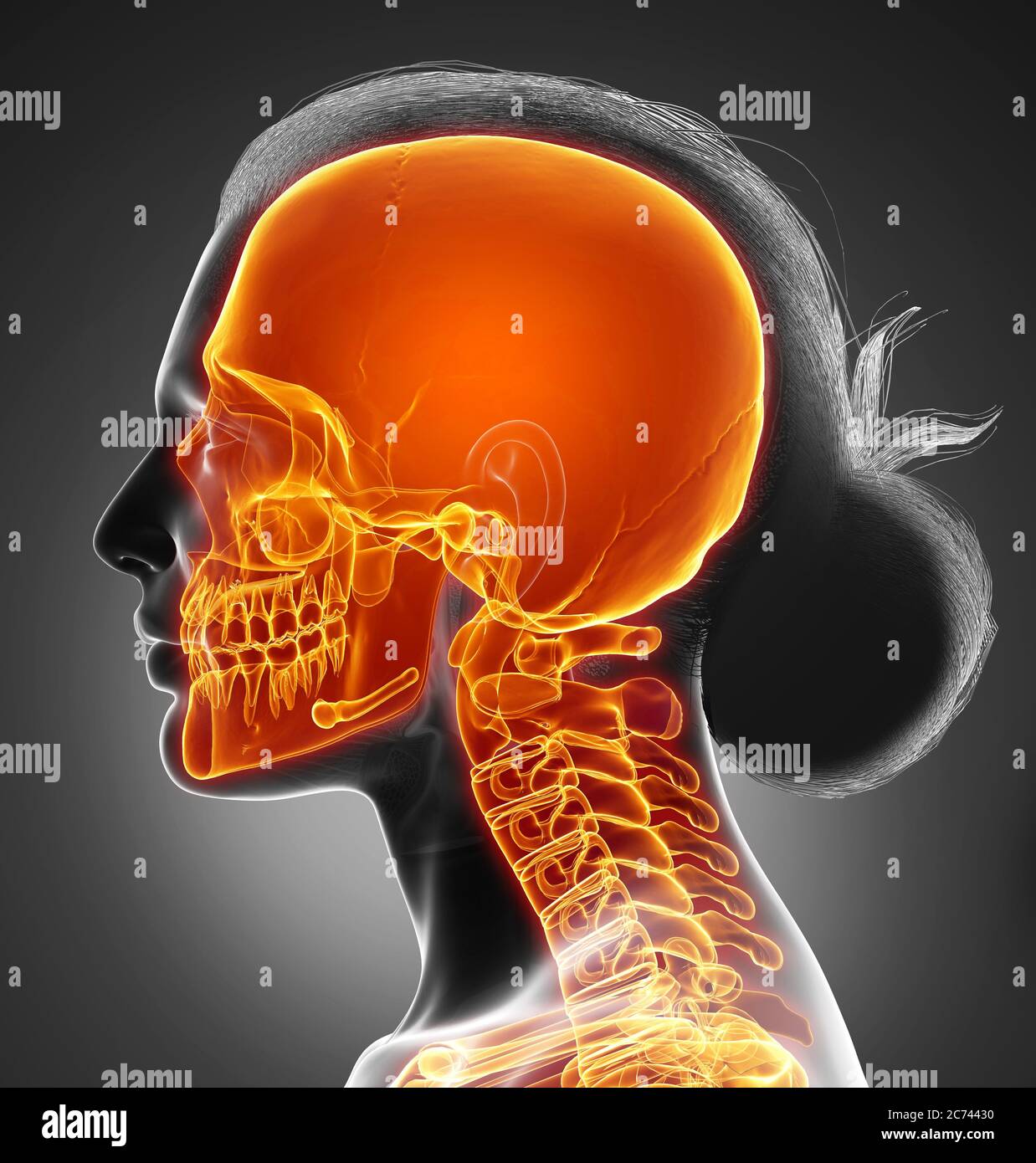 3d rendered, medically accurate illustration highlighted skull Stock ...