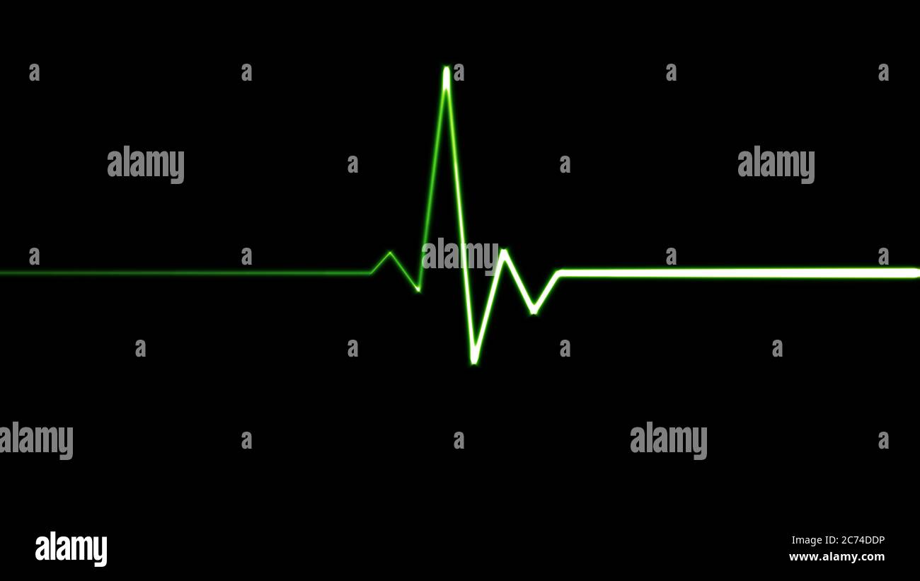 Heart Rate Monitor Flatline Gif