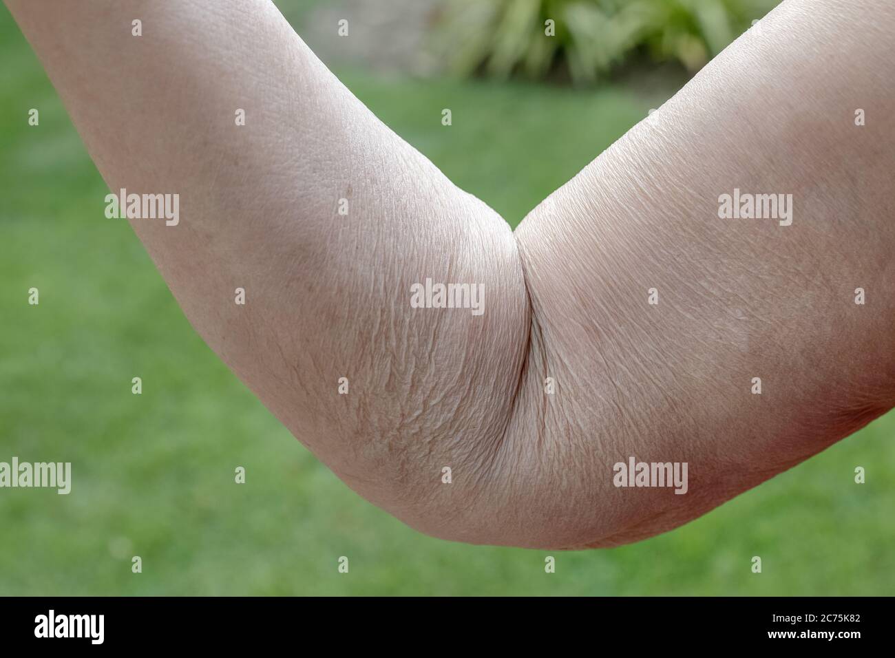 Old skin body hi-res stock photography and images - Alamy