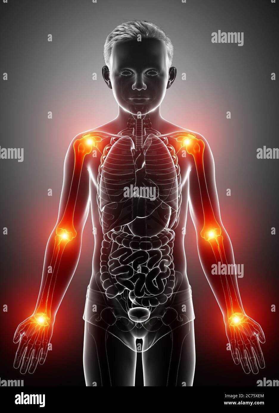 3d Illustration of young Boy arm joint pain Stock Photo - Alamy
