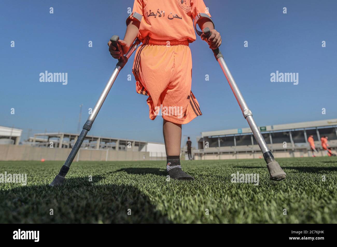 Child amputee hi-res stock photography and images - Alamy