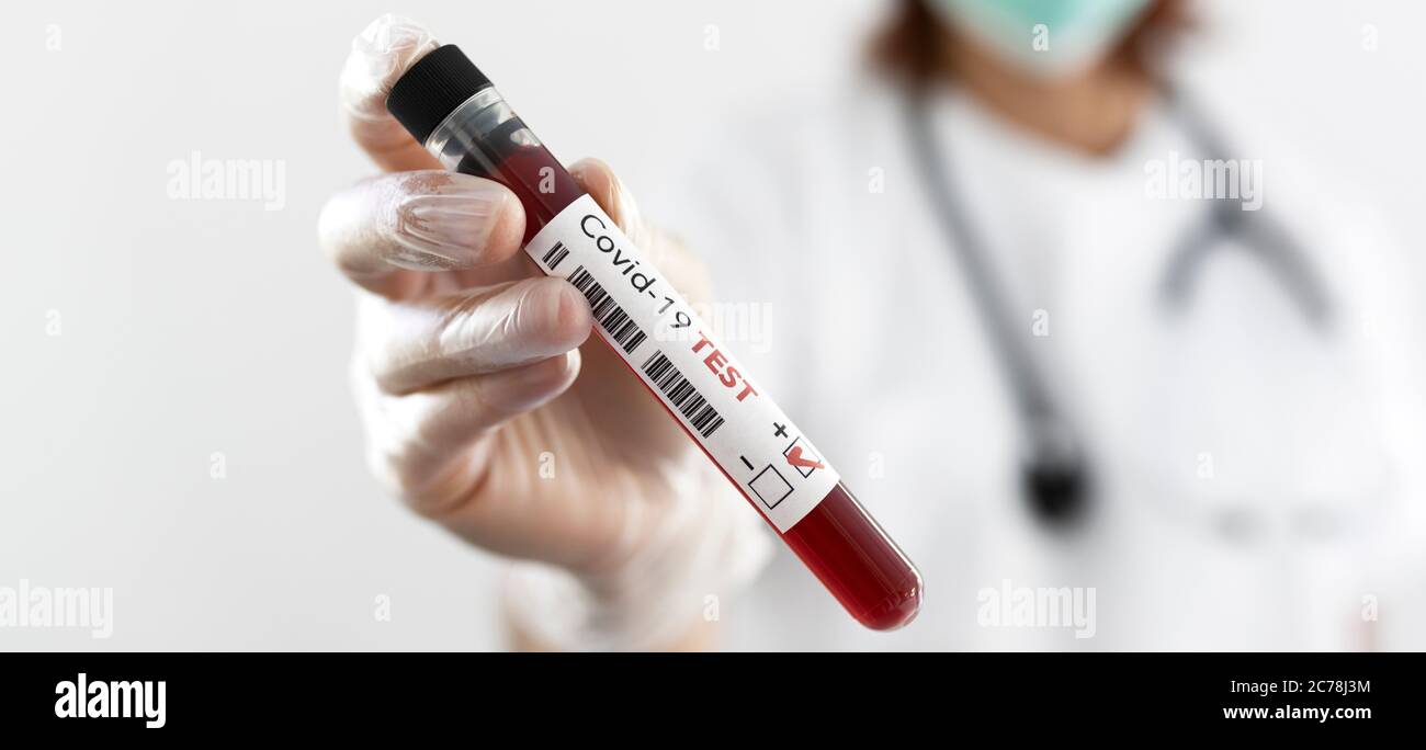 Blood test result hi-res stock photography and images - Alamy