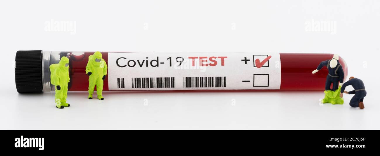 Positive blood test hi-res stock photography and images - Alamy