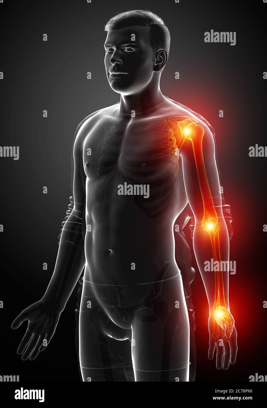 3d Illustration of men arm joint pain Stock Photo - Alamy