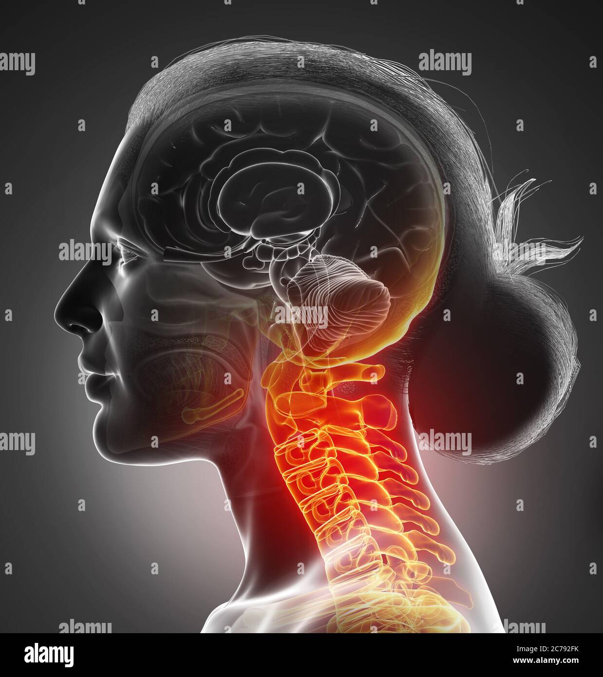 3d rendered, medically accurate illustration of female having a painful ...