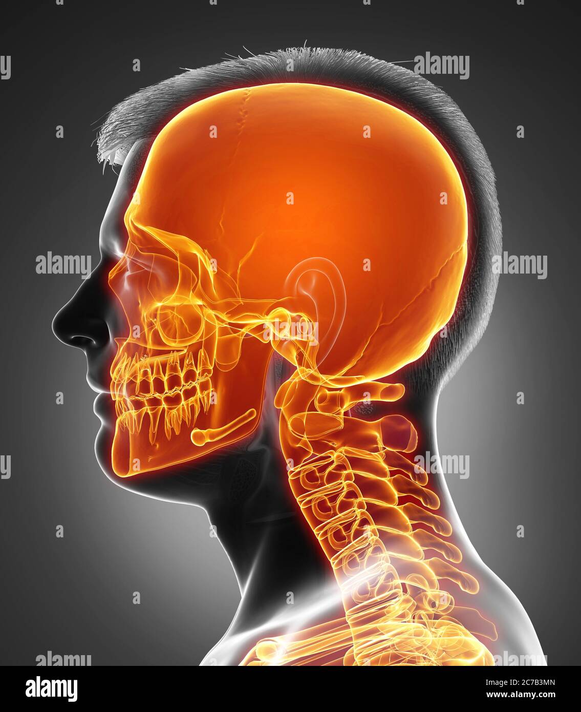 3d rendered, medically accurate illustration highlighted skull Stock ...