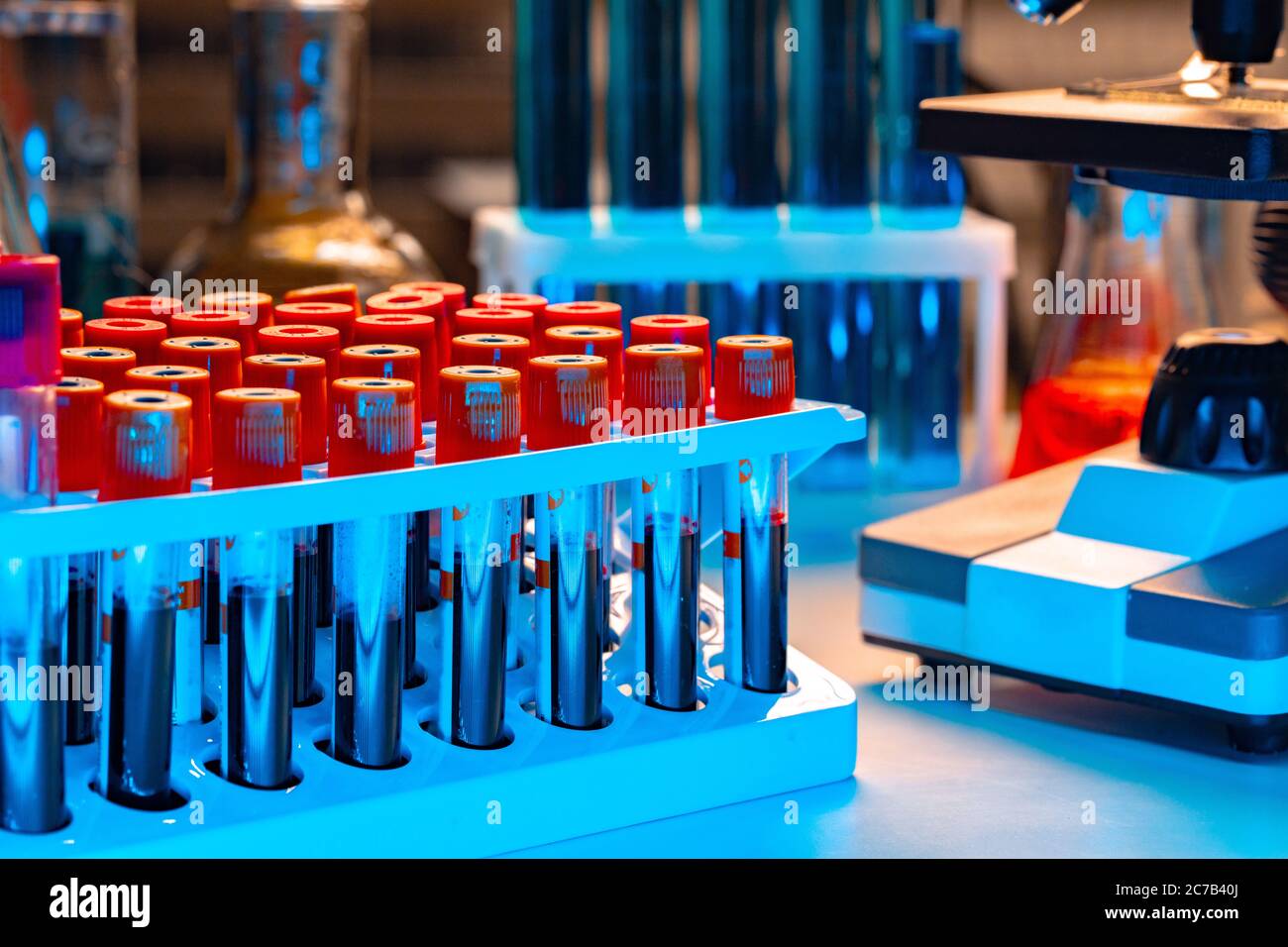 Microscope with blood samples test tubes close up Stock Photo - Alamy
