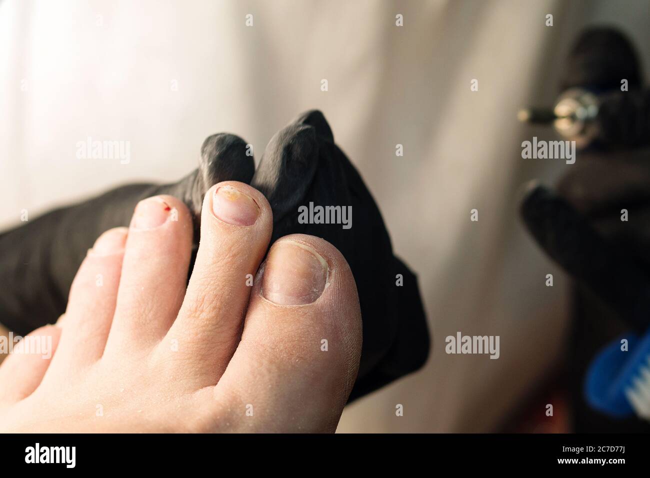 Yellow callus hi-res stock photography and images - Alamy