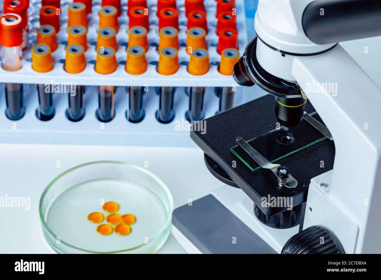 Microscope with blood samples test tubes close up Stock Photo - Alamy