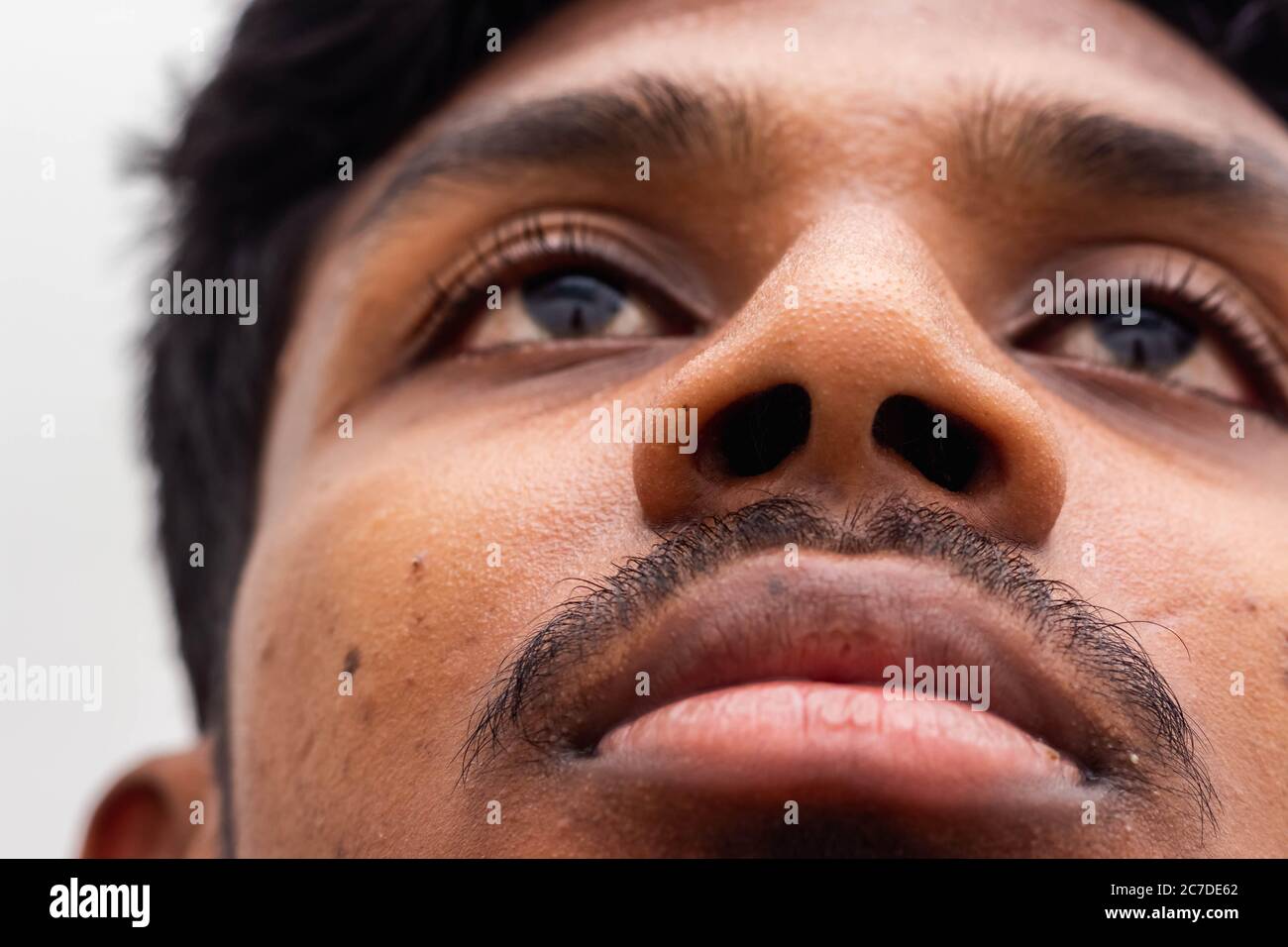 Patient showing his nose for Corona test - Corona virus / Covid-19 ...