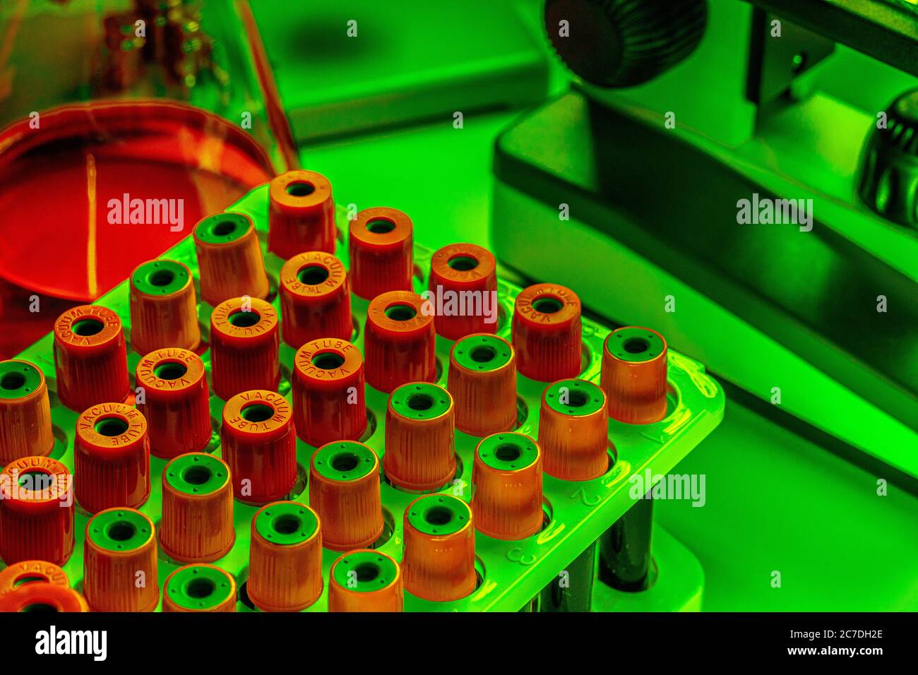 Photo laboratory microscope blood sample hi-res stock photography and ...