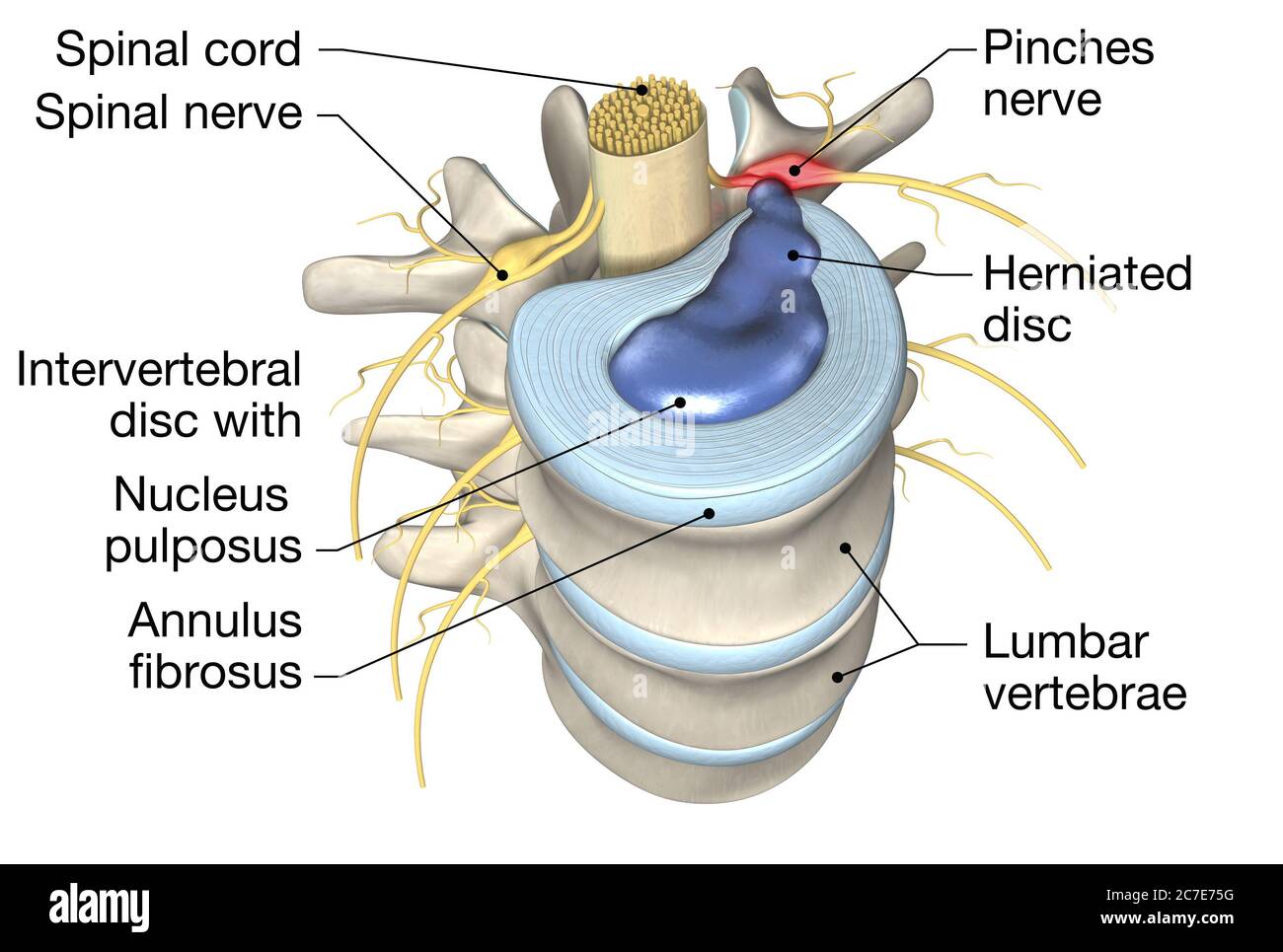 3D illustration showing lumbar vertebra with intervertebral disc ...