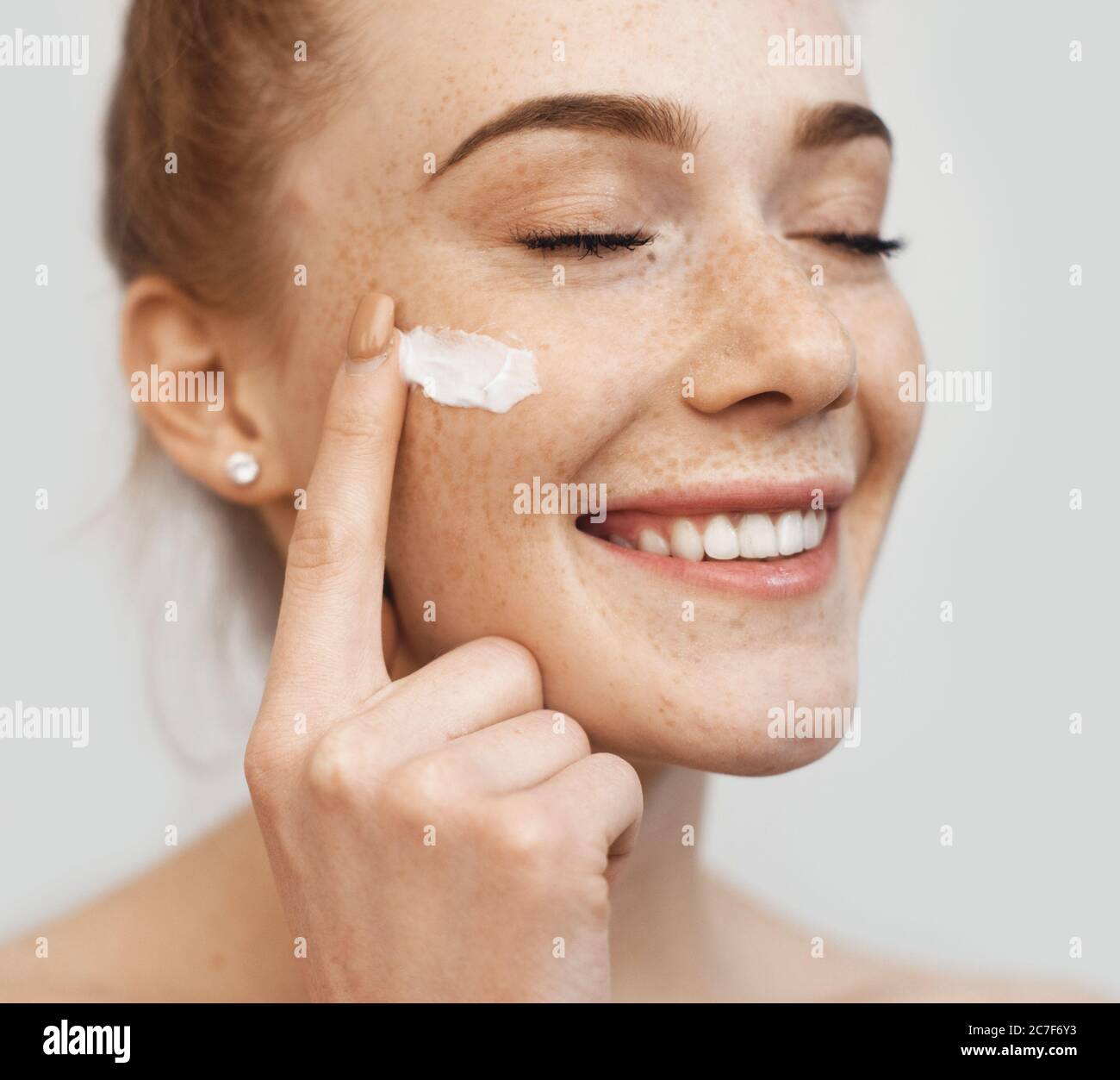 Freckled Face Close Up High Resolution Stock Photography and Images - Alamy