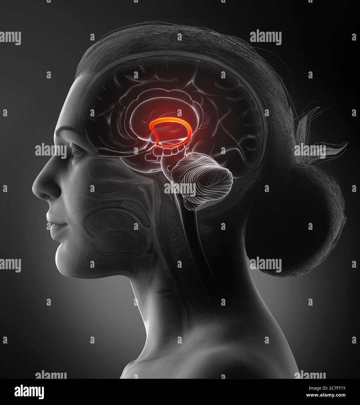 Female brain scan and side hi-res stock photography and images - Alamy