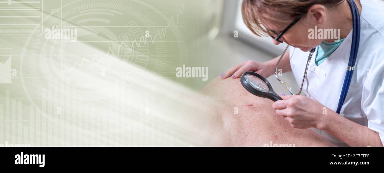 Dermatologist examining the skin on the back of a patient; panoramic ...