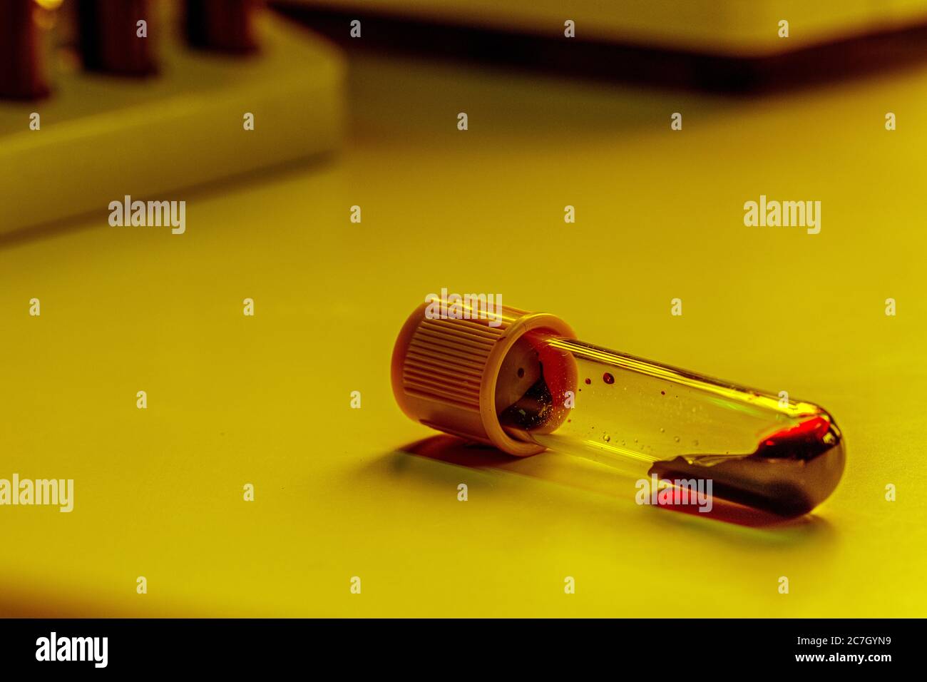 Tubes with blood samples on laboratory desk Stock Photo - Alamy