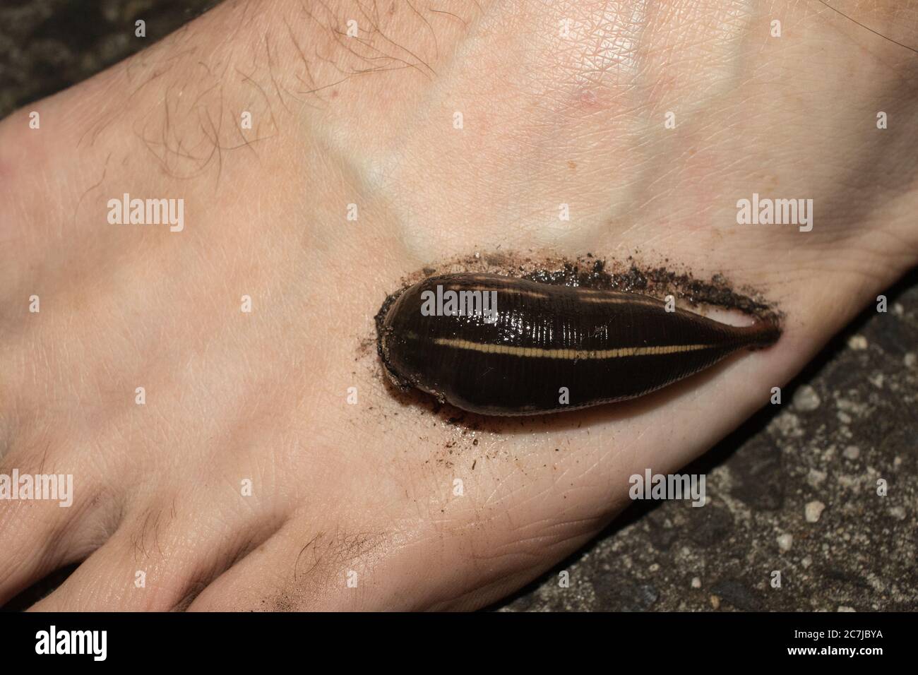 Leech attached to a persons foot Stock Photo - Alamy