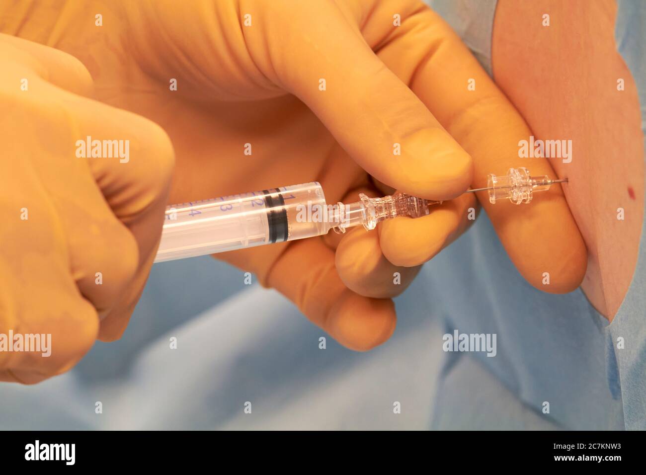 Spinal anesthesia hi-res stock photography and images - Alamy