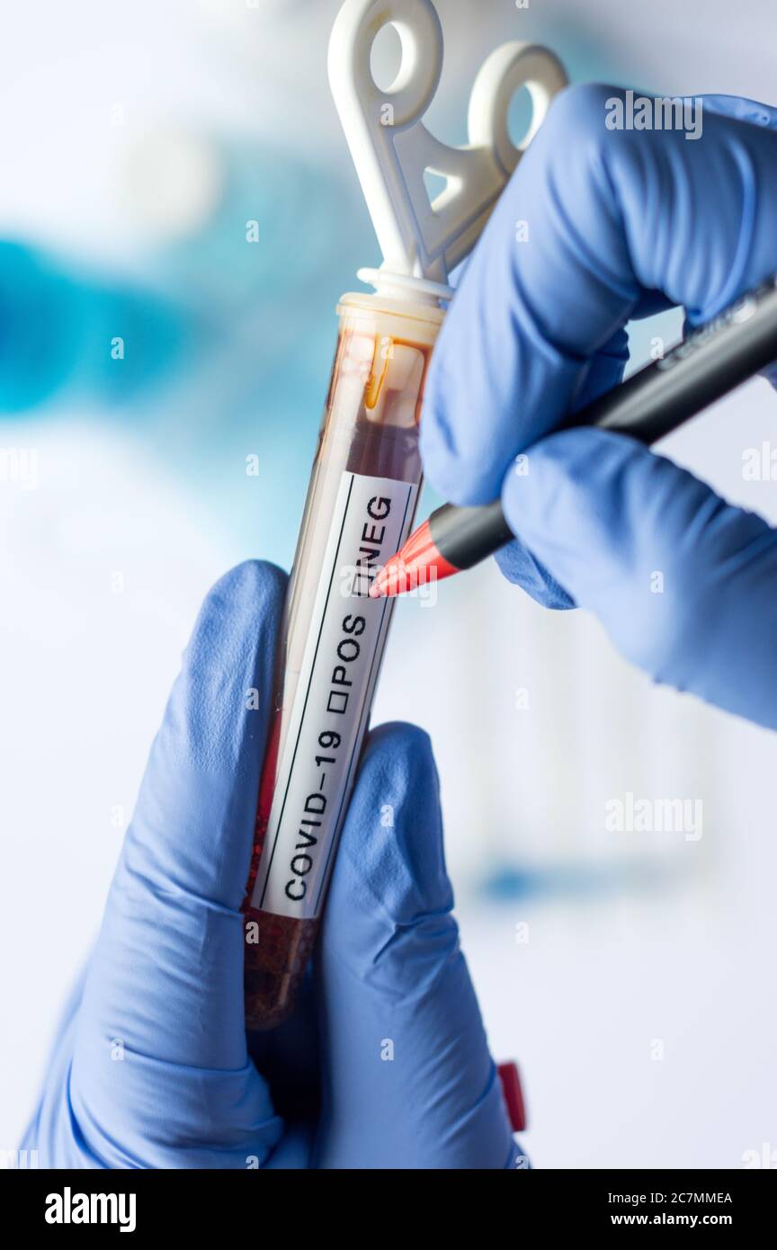 Doctor's lab technician's hand, holding the tube with blood Stock Photo ...