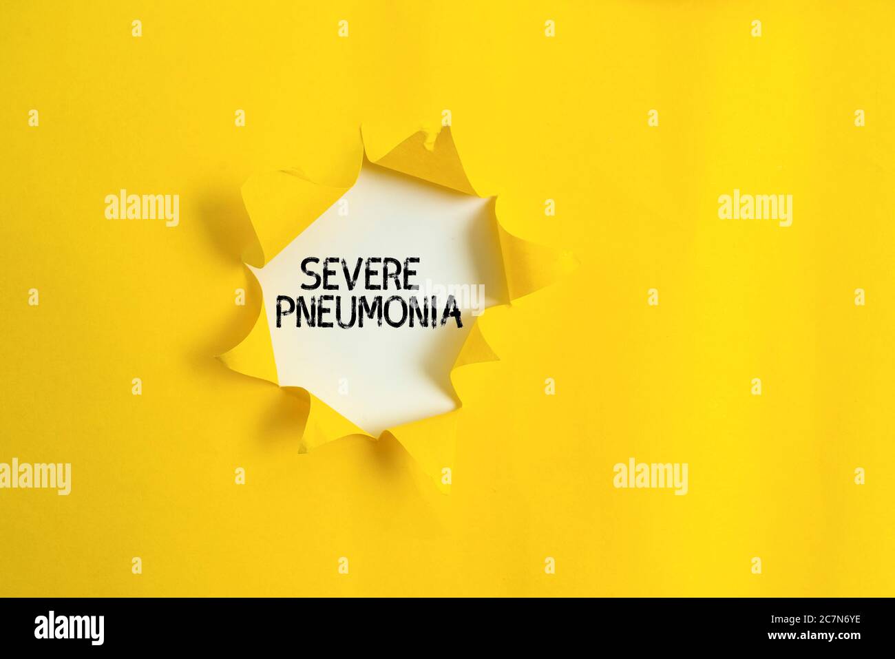 Handwriting text Severe Pneumonia. Conceptual photo acute disease that ...