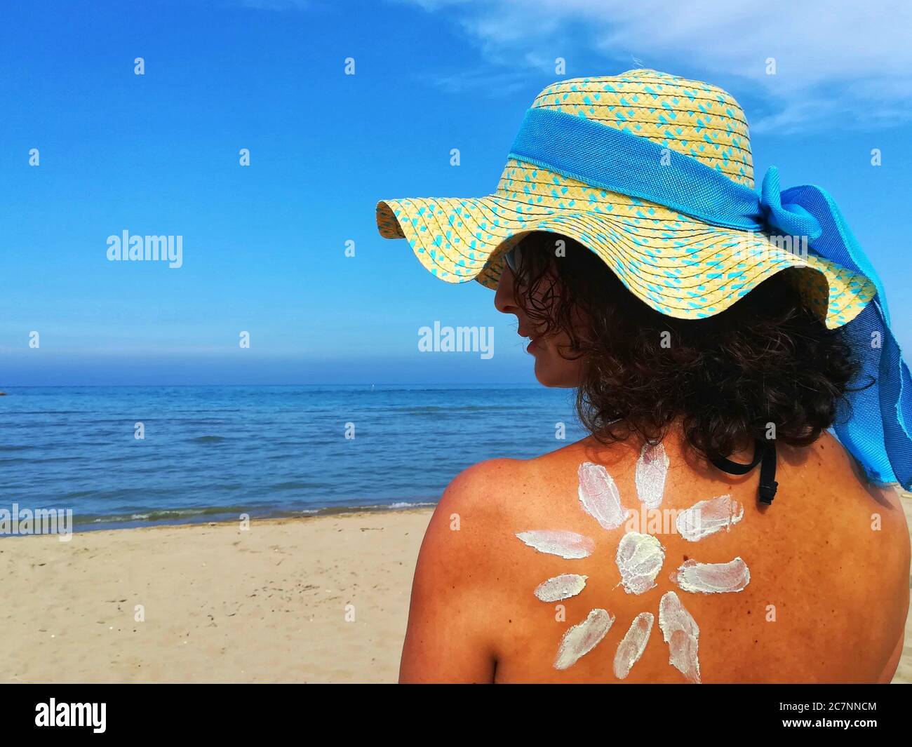 Sunburn and woman hi-res stock photography and images - Alamy