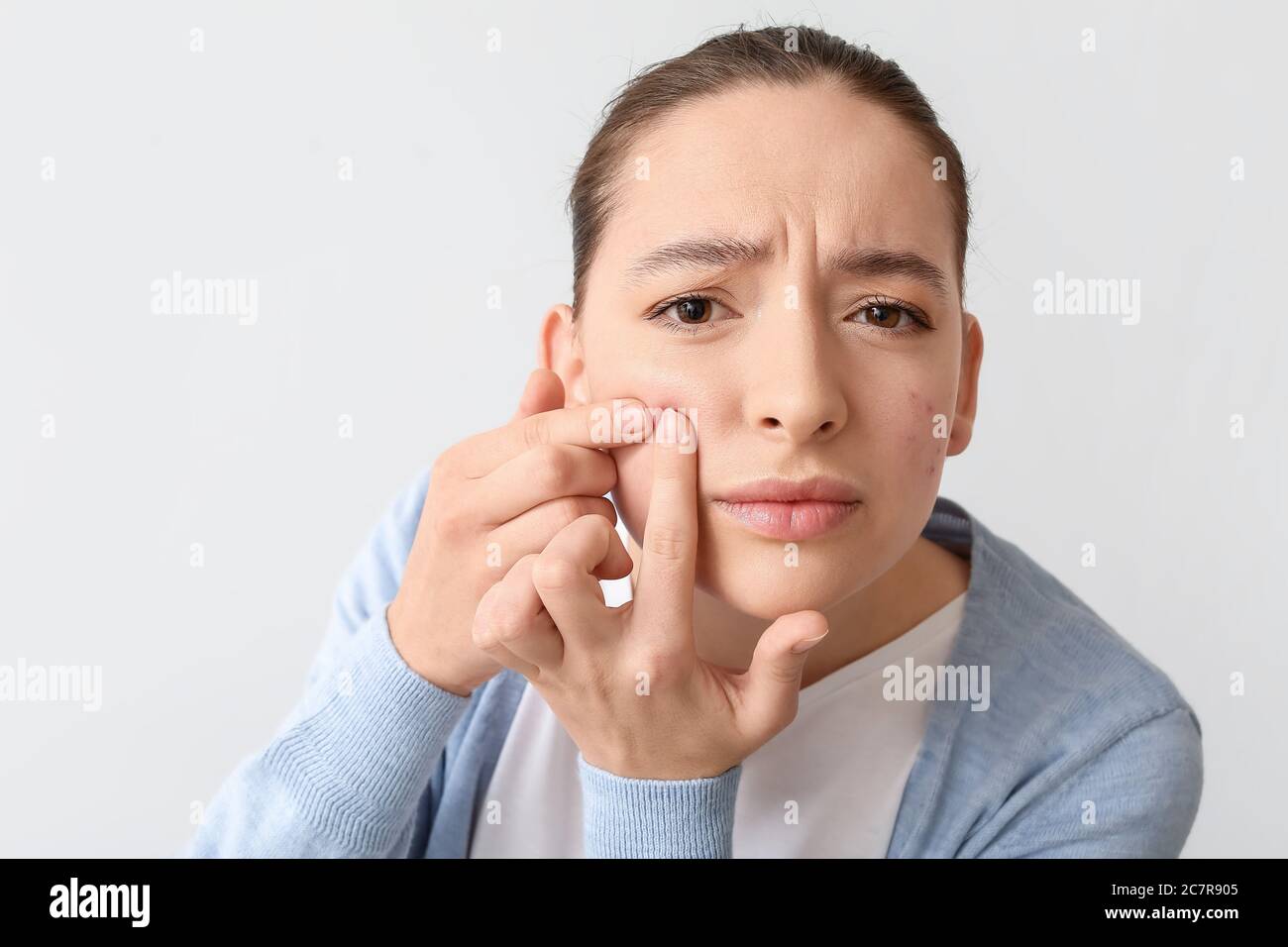 Portrait of young woman with acne problem squishing pimples on light ...