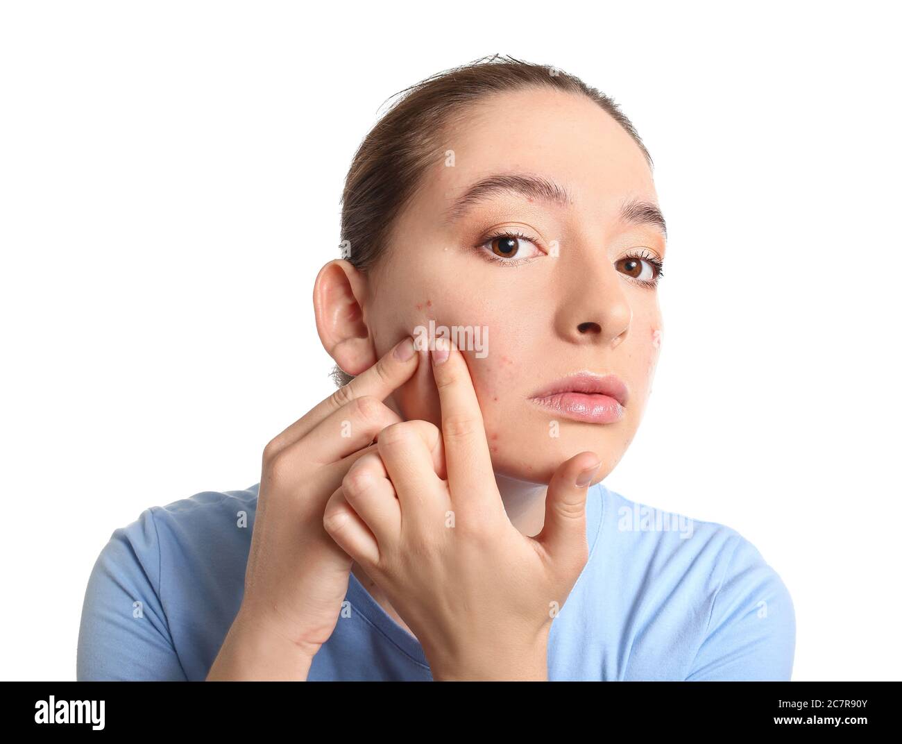 Young woman with acne problem squishing pimples on white background ...