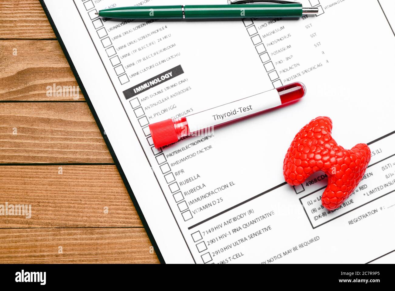 Blood sample in tube with model of thyroid and laboratory test form on ...