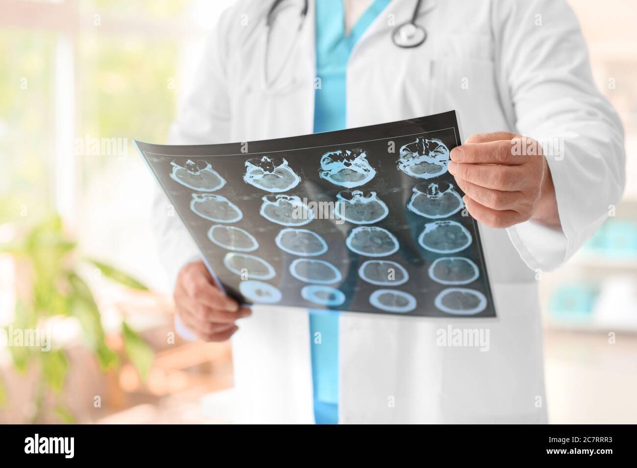 Senior neurologist with MRI scan of human head in clinic Stock Photo ...