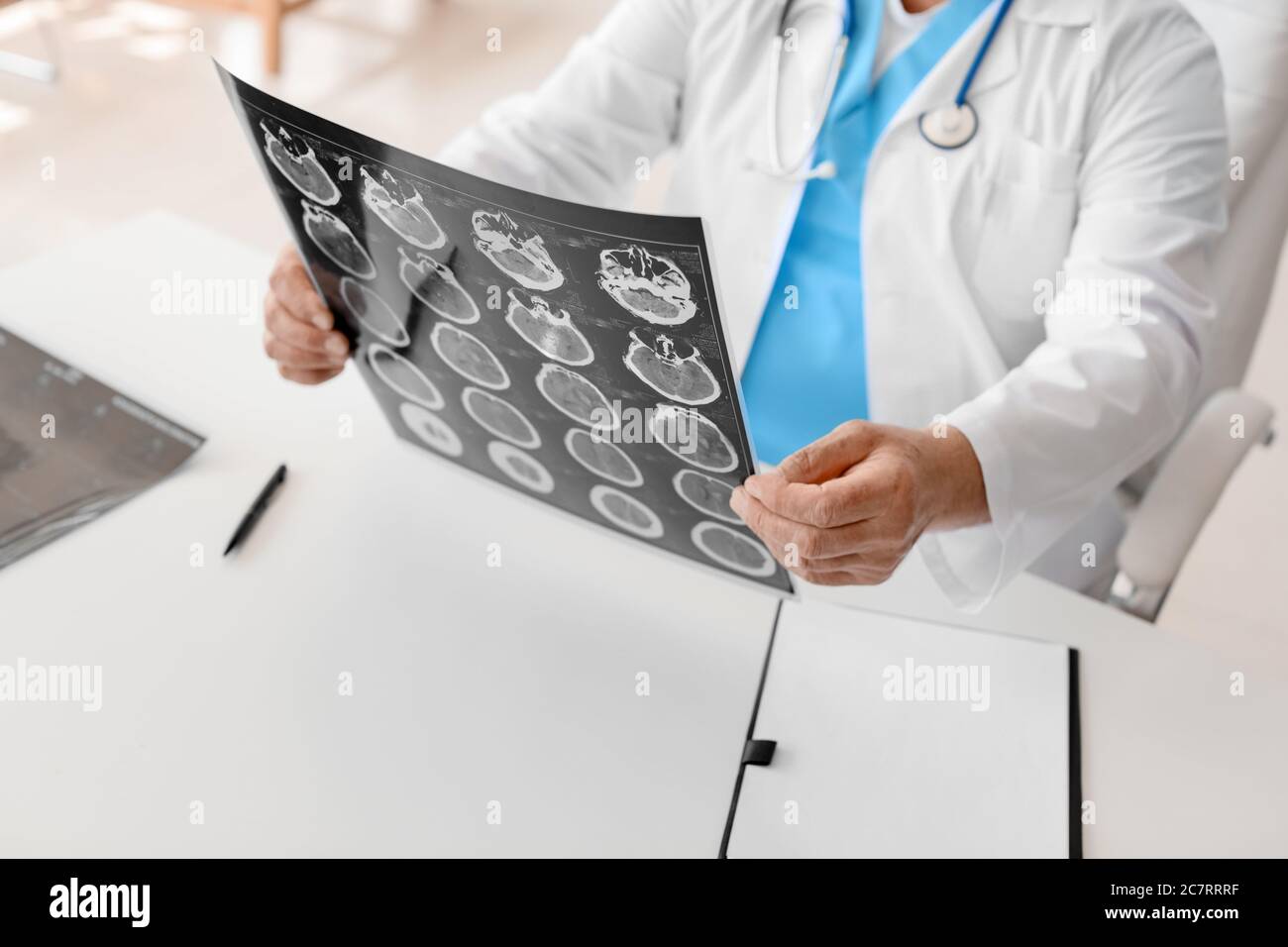 Senior neurologist with MRI scan of human head in clinic Stock Photo ...