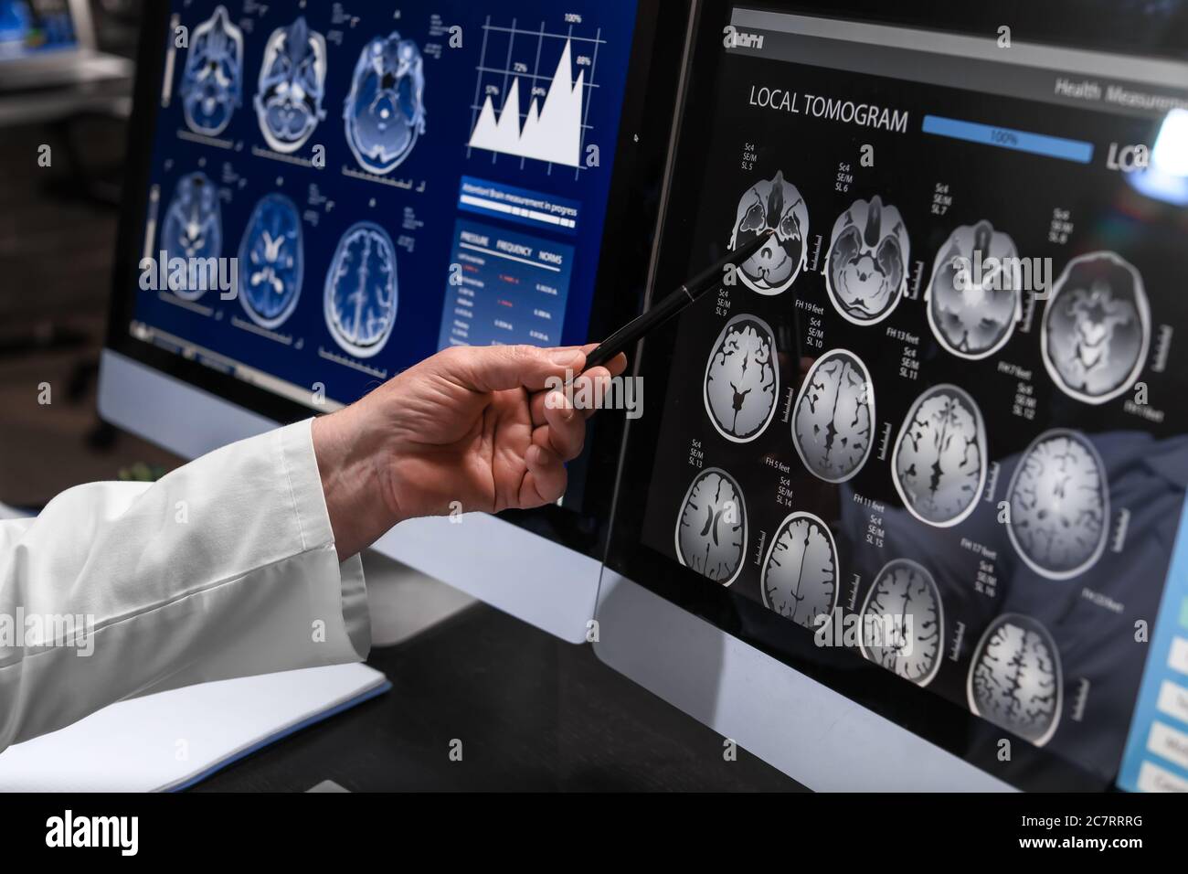 Senior neurologist with MRI scan of human head in clinic Stock Photo ...